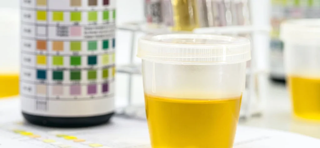 How Long Does Coke Stay in Your System? | South Shores (CA)